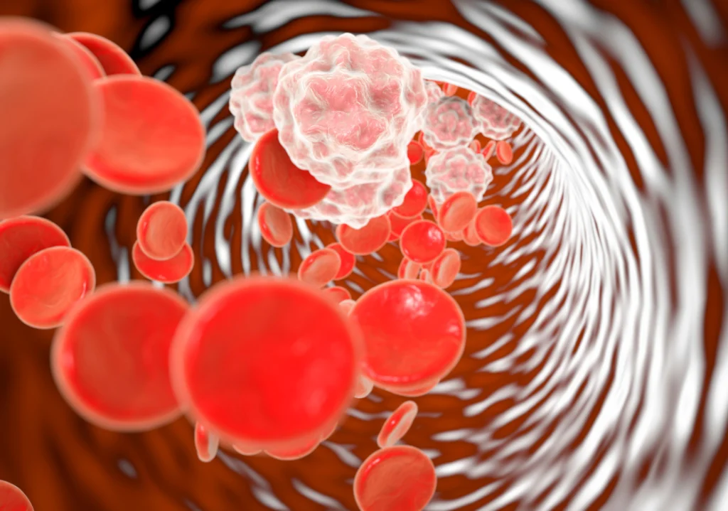 Φλεγμονή: Αιτίες, συμπτώματα και πως να την αντιμετωπίσεις.